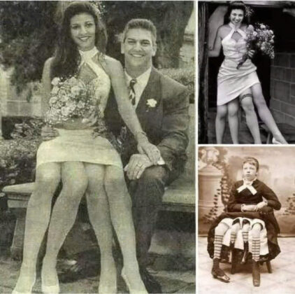The Extraordinary Life of Josephine Myrtle Corbin: The Four-Legged ...